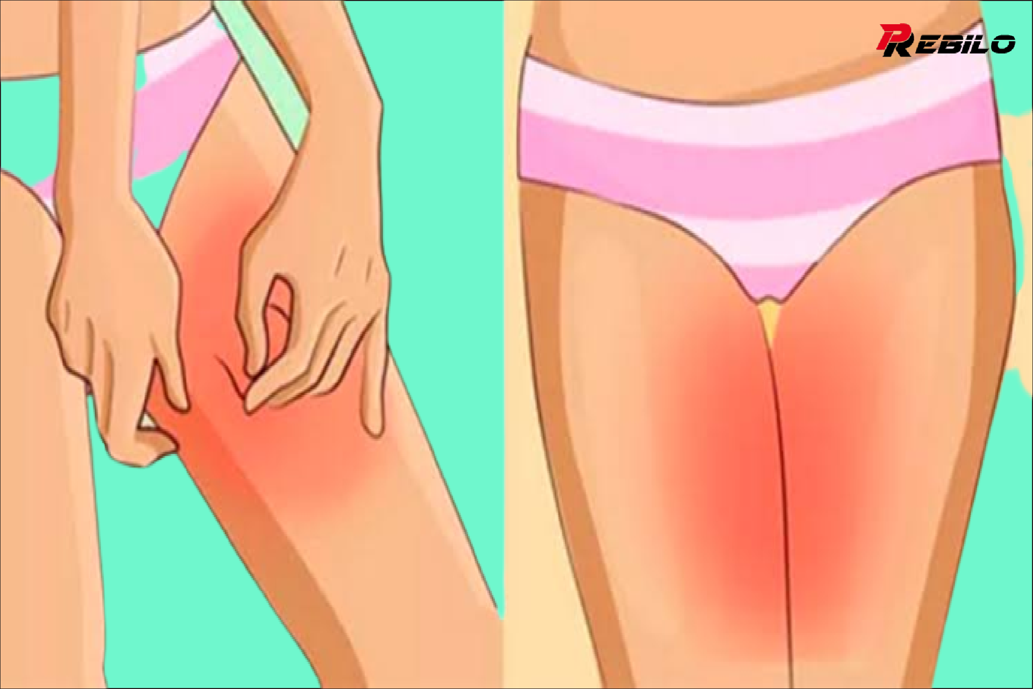 How To Lighten Dark Inner Thighs Naturally 7200